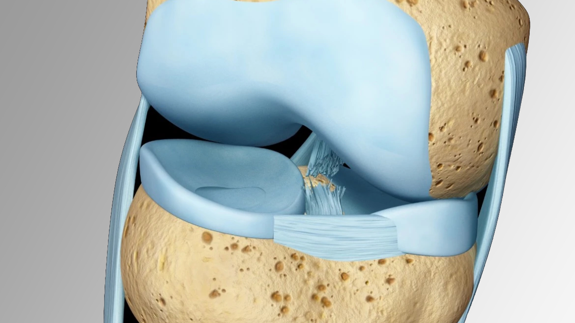 ACL Injury - High Street Clinic